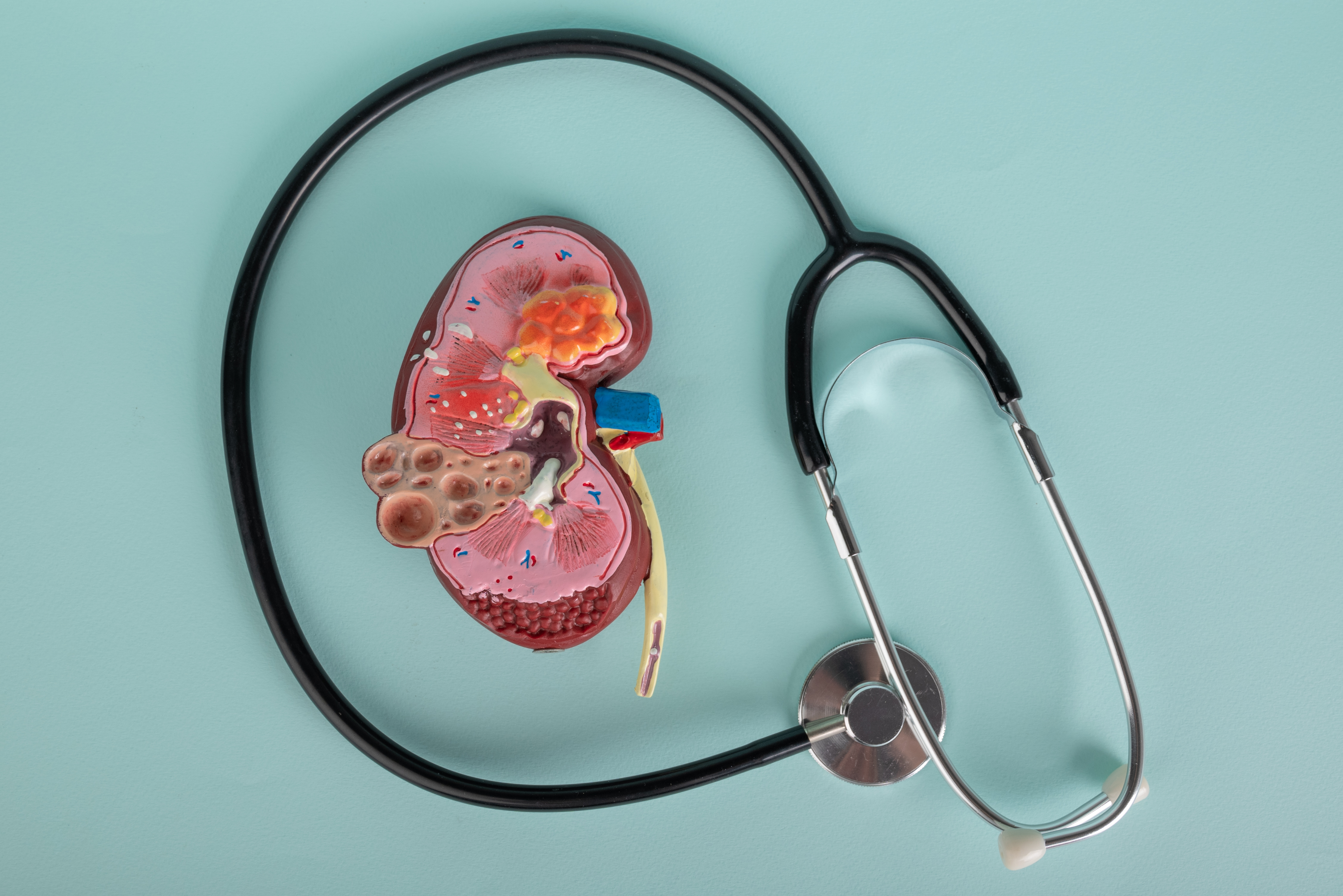 ADA 2025 – Semaglutida reduz risco renal e cardiovascular independente ...